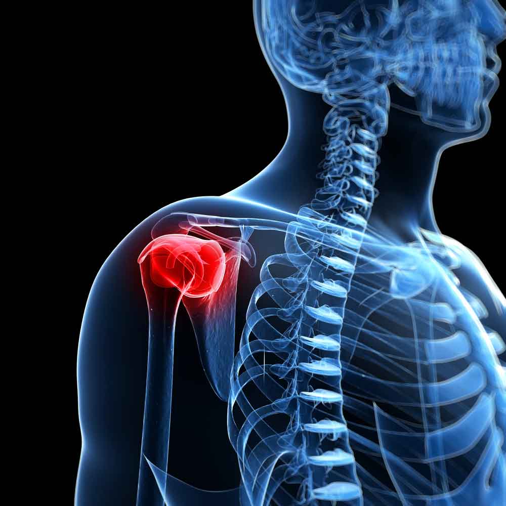 Shoulder Arthritis Shoulder Specialist Austin Round Rock Cedar